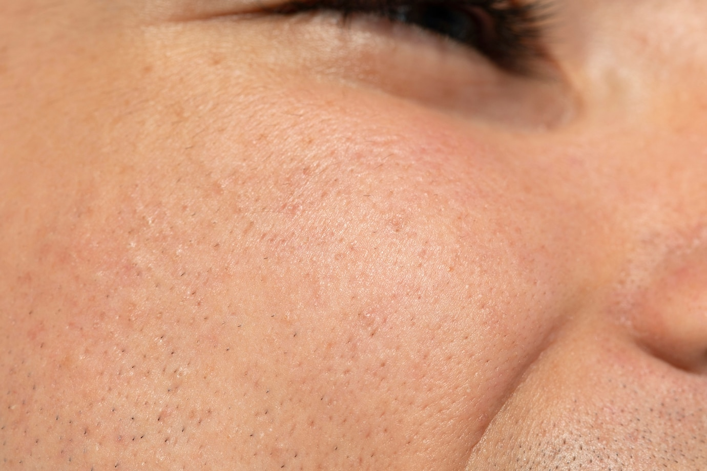 Duo Digest: Is Pore Size Permanent? Here’s What You Should Know ...